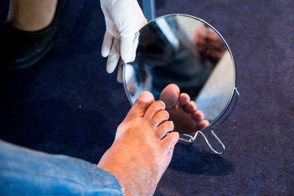 Diabetic Foot Infection: 5 Prevention Tips and 5 Treatment Methods ...