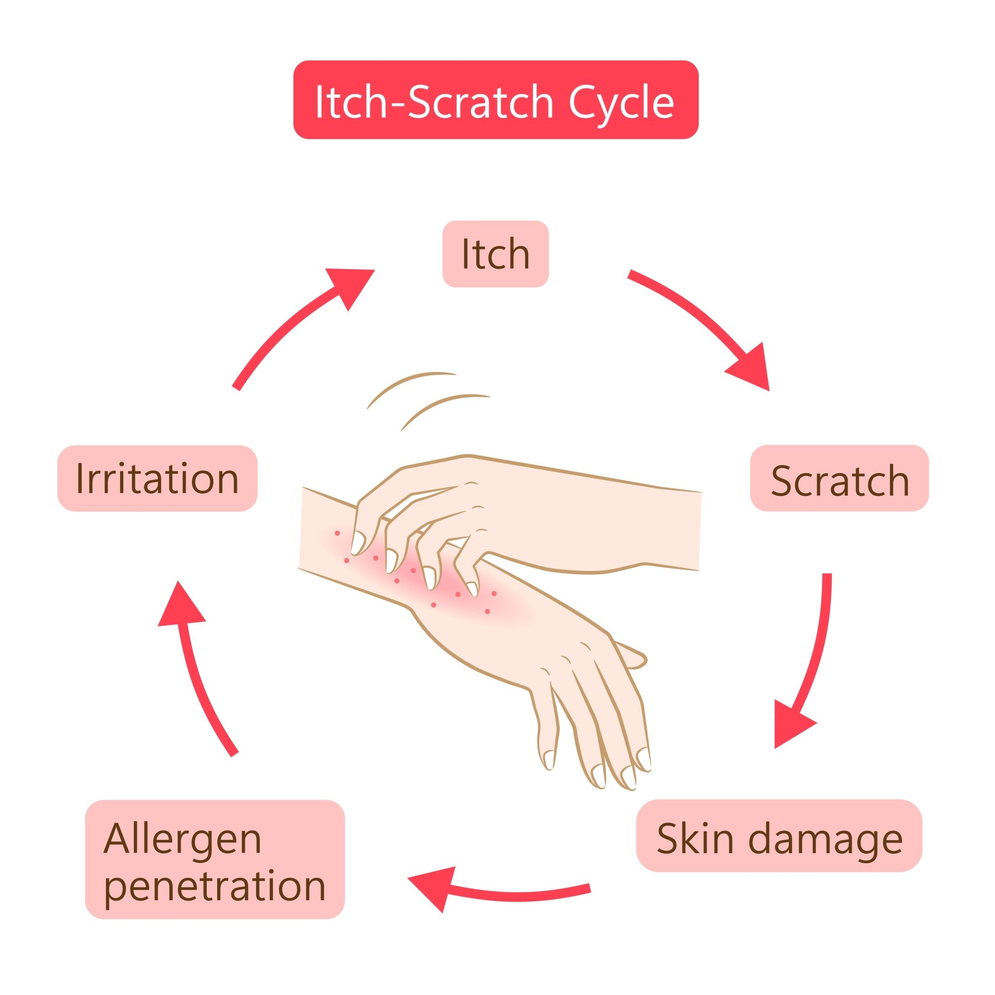 The Never-Ending Itch: Living With Atopic Dermatitis - Medical Channel Asia