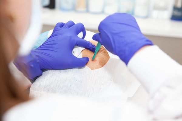 The Skin Biopsy That Spots Cancer Before You Can - Medical Channel Asia